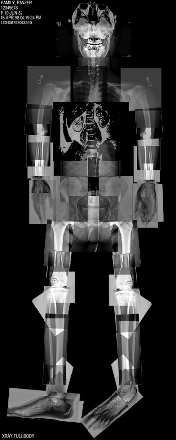 XRAY: digitally stitching a family together – The Connector